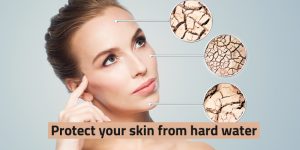 Top 3 Effective Tips to Protect Skin from Hard Water